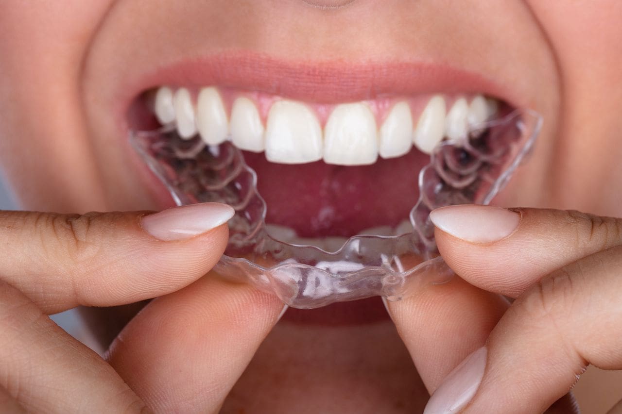 Retainer Care in Long Beach, CA | Garlington Orthodontics